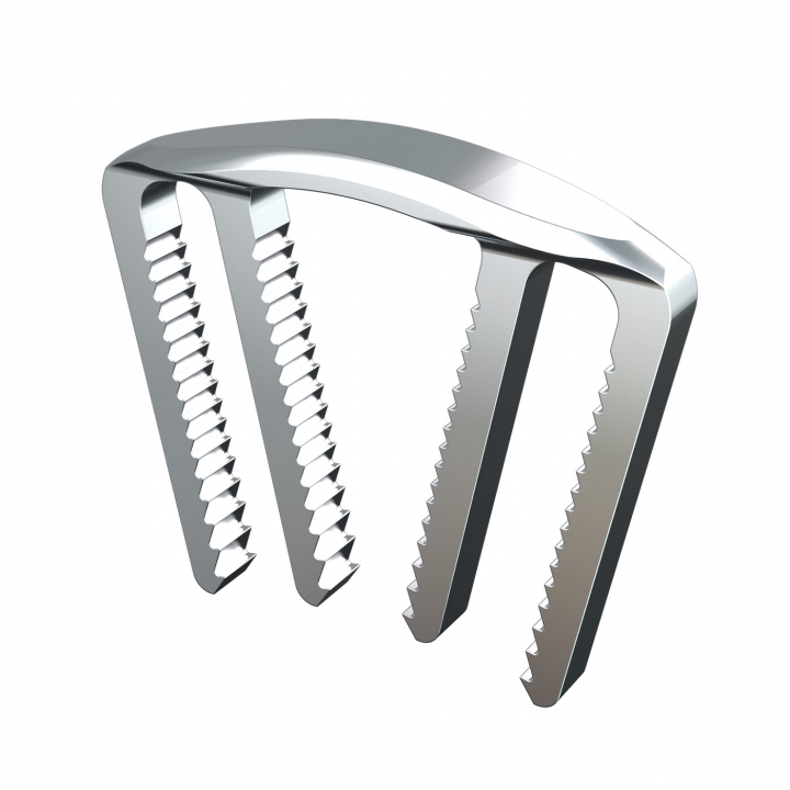 Enovis Dynaclip Forte Staple - Valor Medical