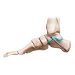 Products - Valor Medical